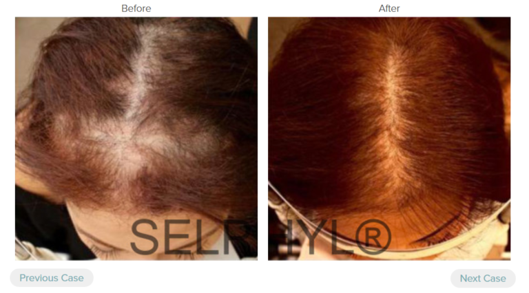 Dr. Kenneth Hughes, Plastic Surgery News Los Angeles